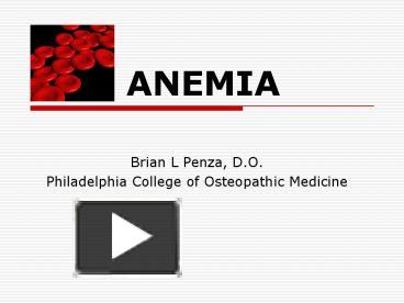 ANEMIA presentation | free to view