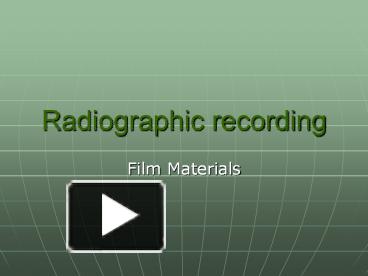 PPT – Radiographic recording PowerPoint presentation | free to download ...