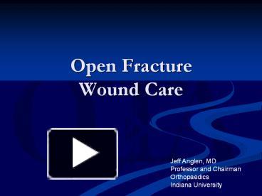Open Fracture Wound Care Jeff Anglen, MD Professor and presentation ...