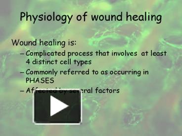 PPT – Physiology of wound healing PowerPoint presentation | free to ...
