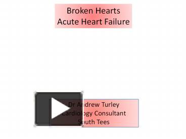 PPT – Dr Andrew Turley PowerPoint presentation | free to view - id ...