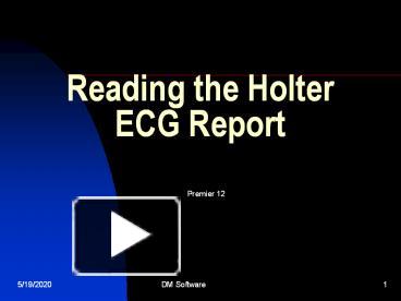 PPT – Reading the Holter ECG Report PowerPoint presentation | free to ...