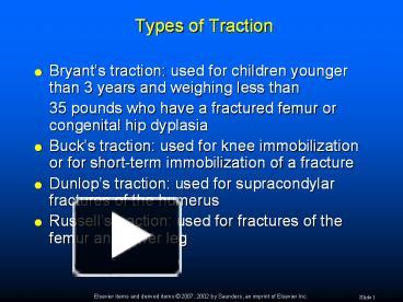 Types of Traction presentation | free to view
