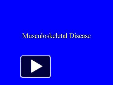 PPT – Musculoskeletal Disease PowerPoint presentation | free to ...