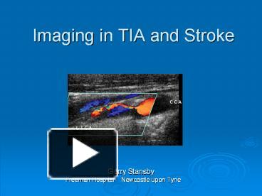 Imaging in TIA and Stroke Gerry Stansby Freeman Hospital presentation ...