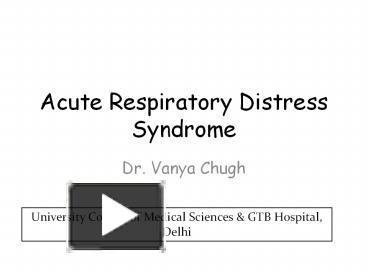 PPT – Acute Respiratory Distress Syndrome PowerPoint presentation ...