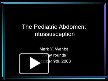 The Pediatric Abdomen: Intussusception presentation | free to view