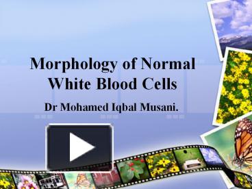 Morphology of Normal White Blood Cells presentation | free to view