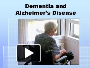 Dementia and Alzheimer’s Disease presentation | free to view