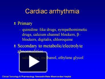 PPT – Cardiac arrhythmia PowerPoint presentation | free to view - id ...