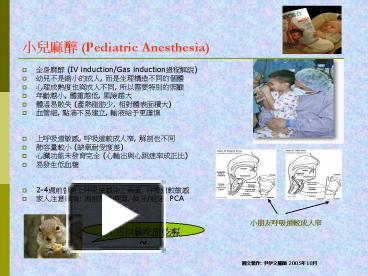Pediatric Anesthesia) presentation | free to view