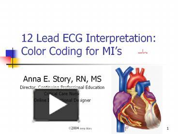 12 Lead ECG Interpretation: Color Coding for MI’s presentation | free ...