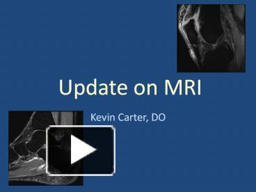PPT – Update on MRI PowerPoint presentation | free to view - id: 3c6cb9 ...