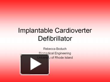Implantable Cardioverter Defibrillator presentation | free to download