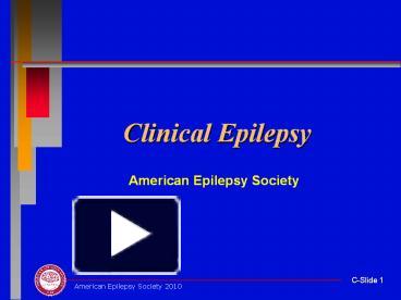 Clinical Epilepsy presentation | free to view