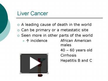 PPT – Liver Cancer PowerPoint presentation | free to view - id: 3ca6c-YjE3Y