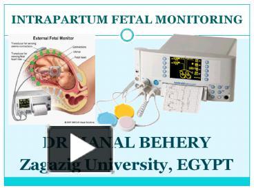 Intrapartum fetal monitoring for undergraduate presentation | free to ...