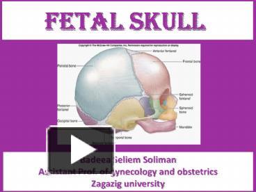 FETAL Skull for undergraduate presentation | free to download