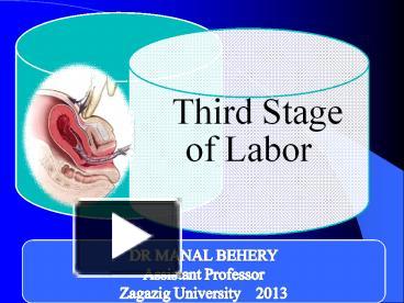 THIRD STAGE OF LABOR presentation | free to download