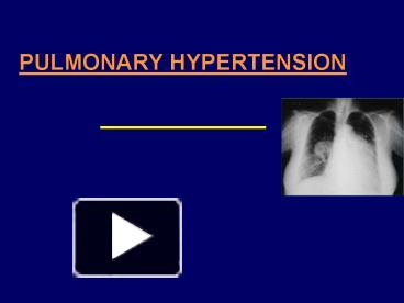PPT – PULMONARY HYPERTENSION ??? ??? ?? ????? PowerPoint presentation ...