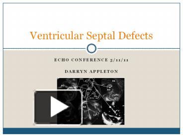 Echo Conference 5/11/11 presentation | free to download