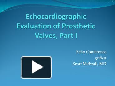 Echocardiographic Evaluation of Prosthetic Valves, Part I presentation ...