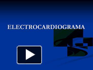 ELECTROCARDIOGRAMA presentation | free to download