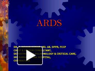 ARDS presentation | free to view