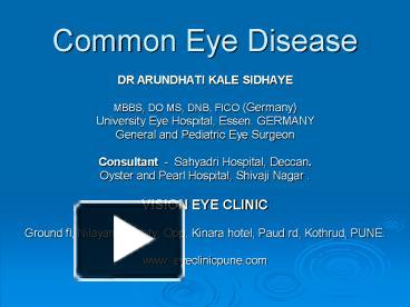 Common Eye Disease presentation | free to view