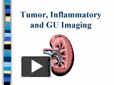 Tumor, Inflammatory and GU Imaging presentation | free to download
