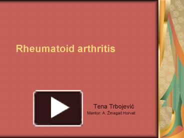 Rheumatoid arthritis presentation | free to view