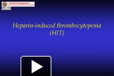 Heparin-induced thrombocytopenia (HIT) presentation | free to view