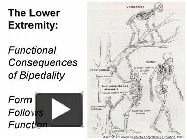 LOWER EXTREMITY presentation | free to view