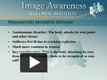 Rheumatoid Arthritis Defined presentation | free to view