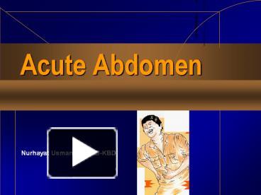 Acute Abdomen presentation | free to download