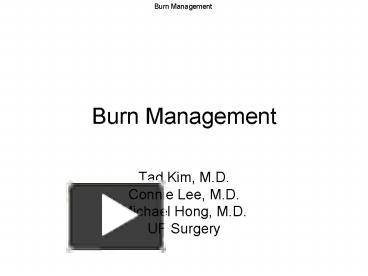Burn Management presentation | free to view