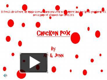 Chicken Pox presentation | free to view