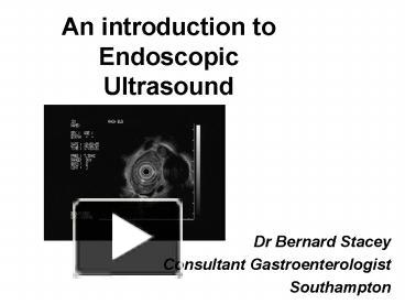 An introduction to Endoscopic Ultrasound presentation | free to view