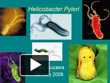 Helicobacter Pylori presentation | free to view