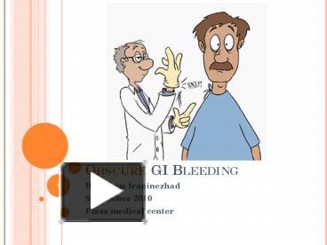 Obscure GI Bleeding presentation | free to view