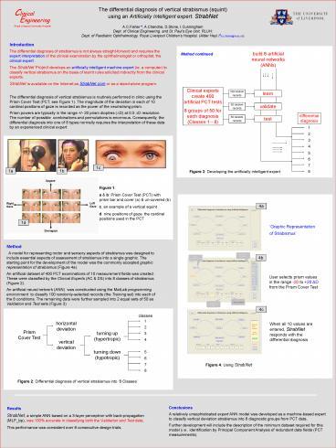 The differential diagnosis of vertical strabismus (squint) presentation ...