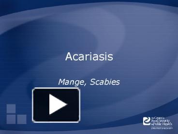 Acariasis presentation | free to download