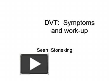 DVT: Symptoms and work-up presentation | free to view