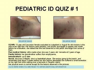 PPT – PEDIATRIC ID QUIZ PowerPoint presentation | free to view - id ...