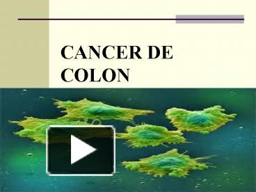 CANCER DE COLON presentation | free to download