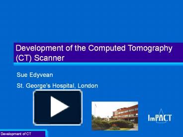 Development of the Computed Tomography (CT) Scanner presentation | free ...