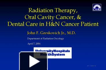 PPT – Radiation Therapy, Oral Cavity Cancer, PowerPoint presentation ...