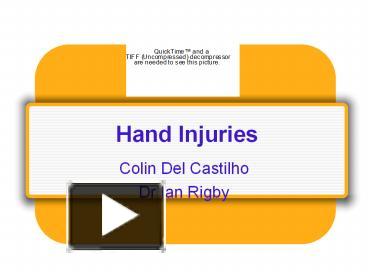 Hand Injuries presentation | free to download