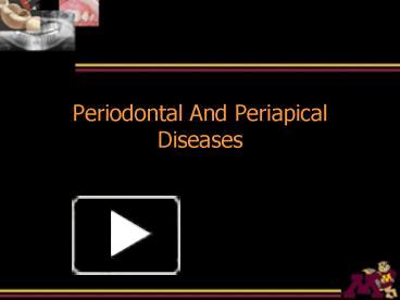 PPT – Periodontal And Periapical Diseases PowerPoint presentation ...
