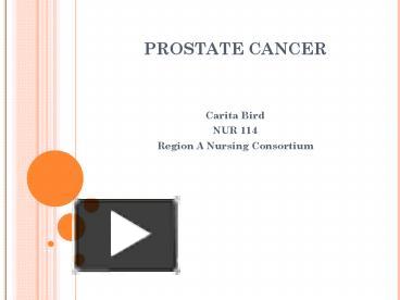 PPT – PROSTATE CANCER PowerPoint presentation | free to view - id ...